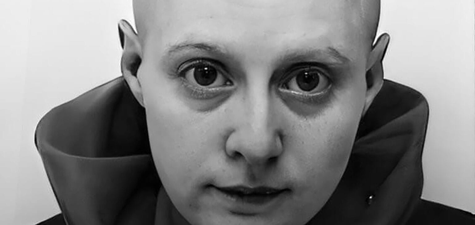 Barbora Skrlová | Pahuuden anatomia